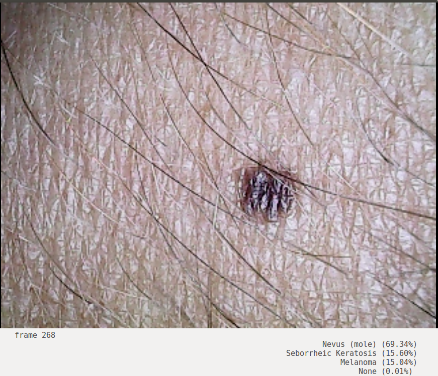 Doctor Hazel | Devpost