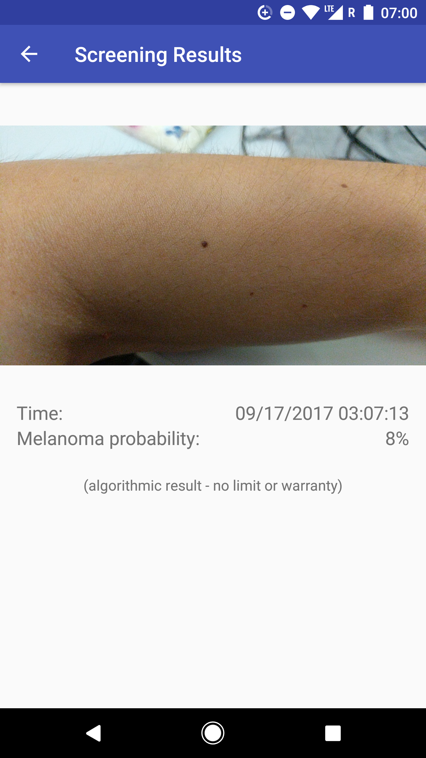 Dr. Jon's Skin Cancer Screening | Devpost