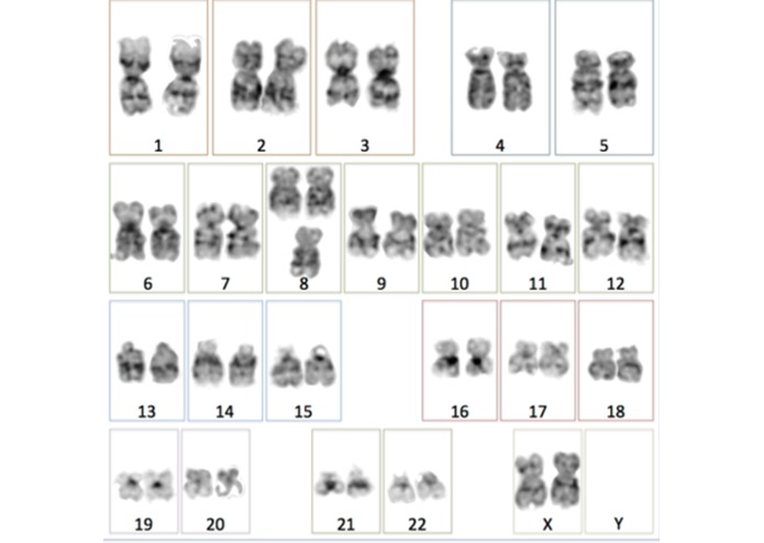 Automatic Karyotyping System | Devpost
