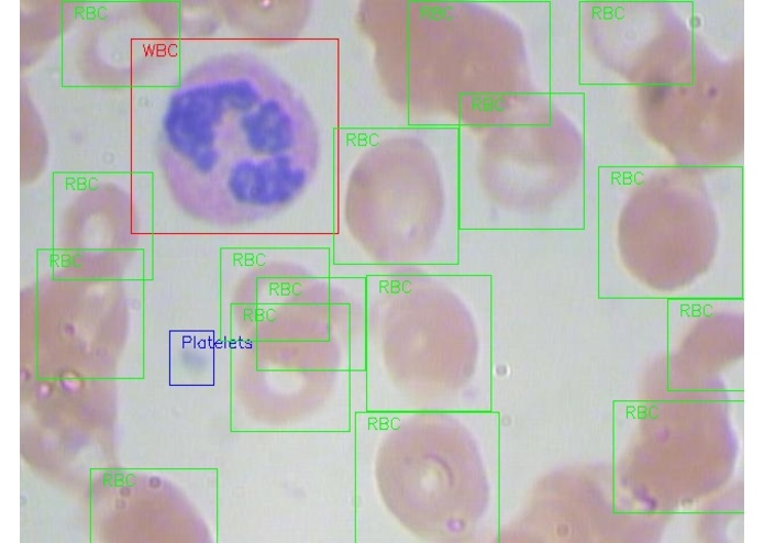 Online White Blood Cell Detection and Counting | Devpost