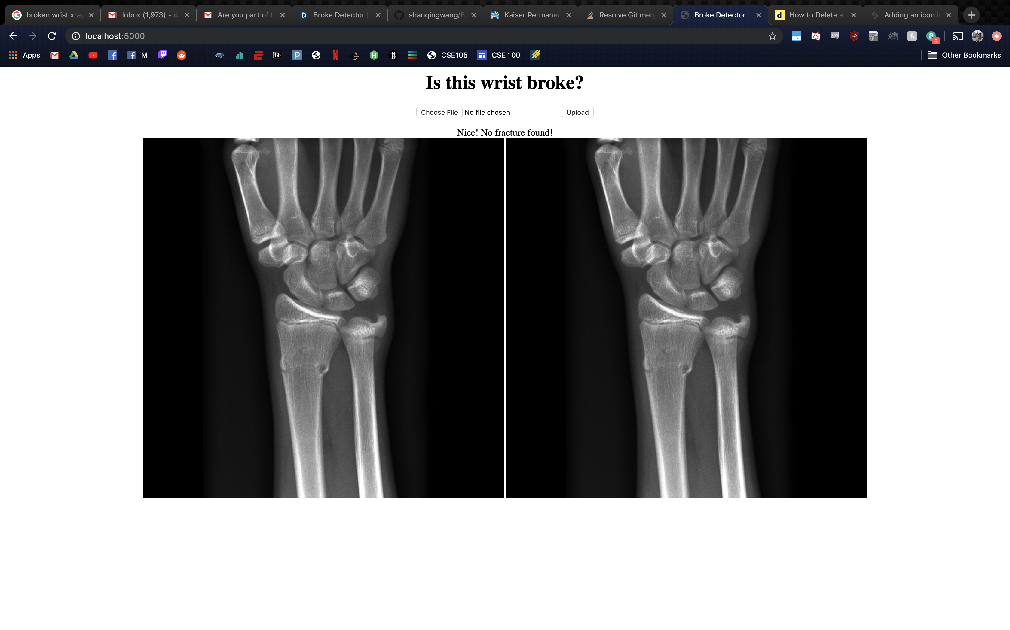 Broke Detector | Devpost