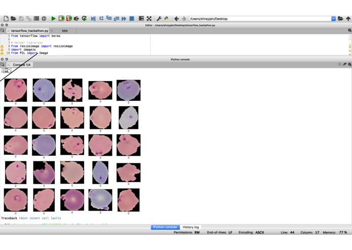 Malaria Cell Detection | Devpost