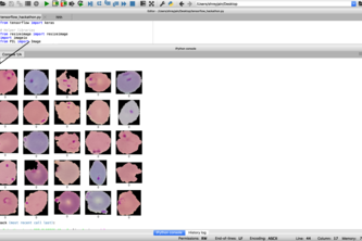 Malaria Cell Detection | Devpost