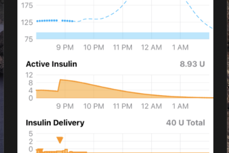 Loop: Accessible & Customized Automatic Insulin Delivery | Devpost