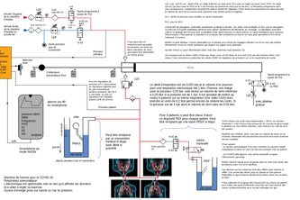 Low cost mechanical ventilator | Devpost