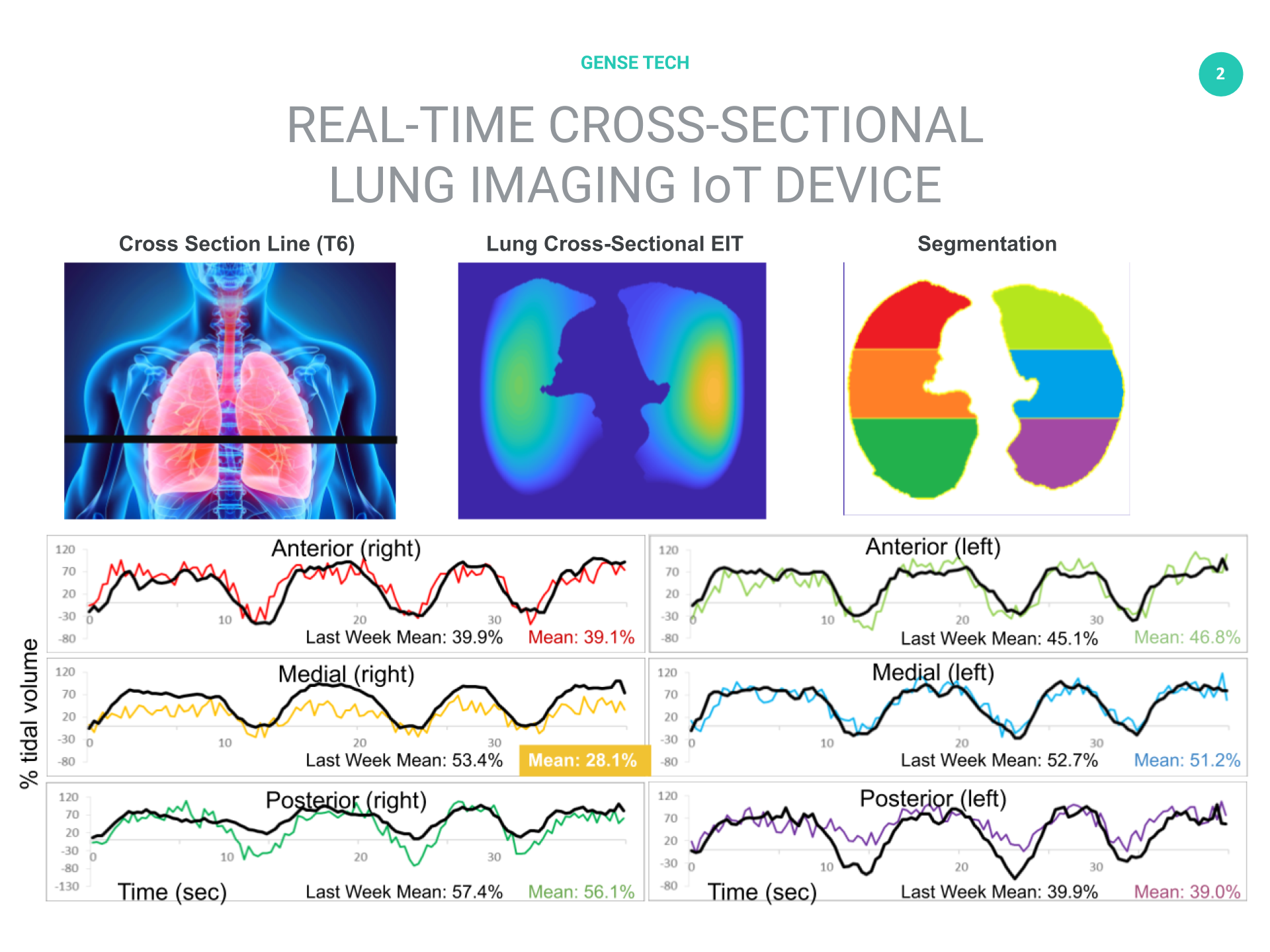 Lung imaging IoT for remote monitoring in isolation | Devpost