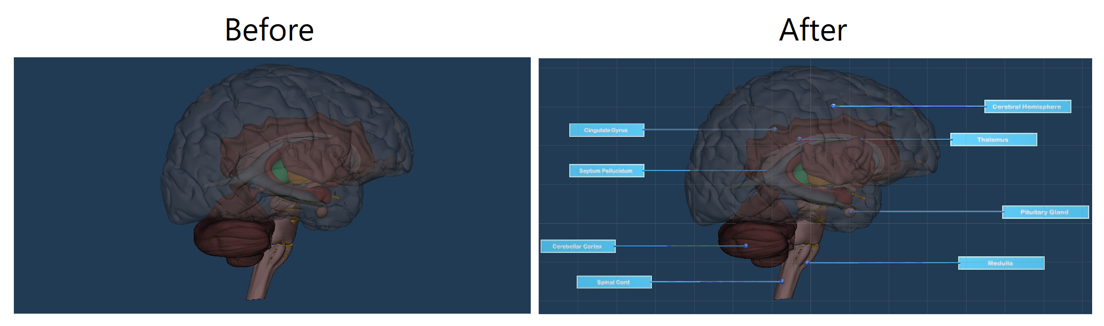 AR Anatomy | Devpost