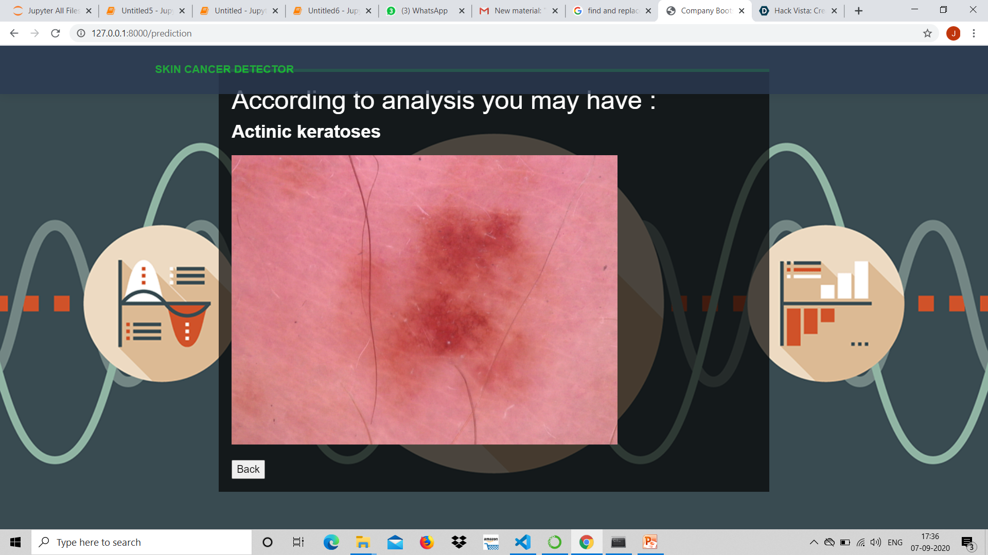 Skin Cancer Detector | Devpost