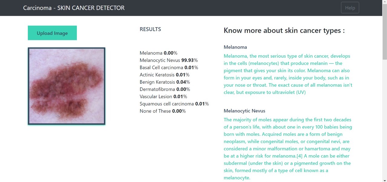 Carcinoma - Skin Cancer Detection | Devpost