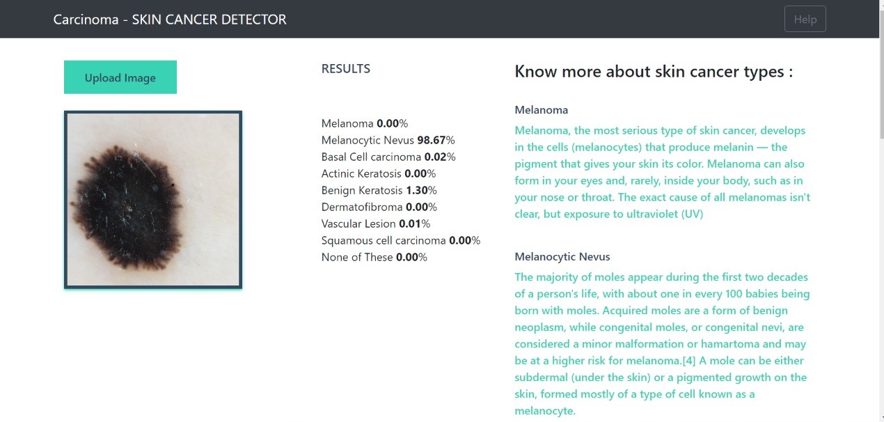Carcinoma - Skin Cancer Detection | Devpost