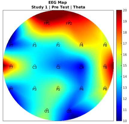EEG_data_visualization_in_MATLAB | Devpost
