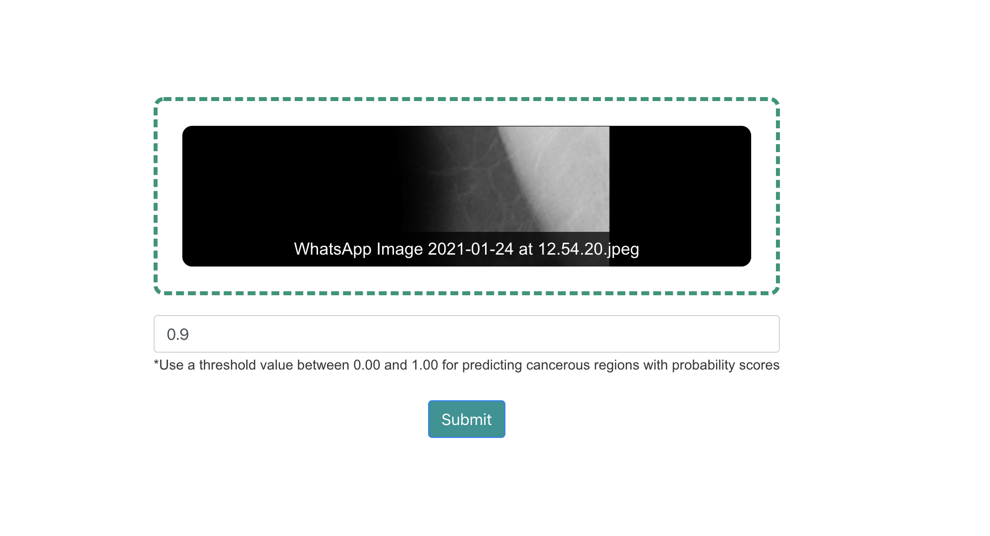 MEdiScan: Breast Lesion detection | Devpost