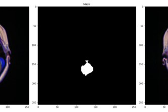 Brain Tumor Segmentation Using ResUNet | Devpost