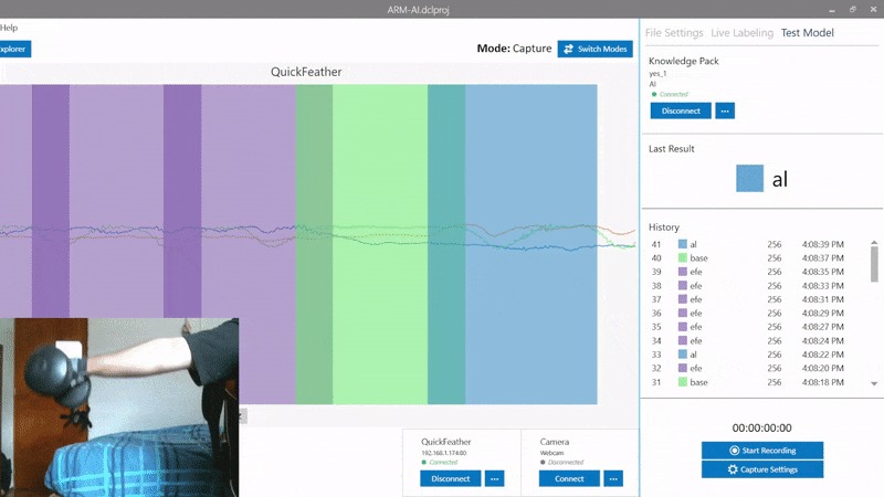 Azure Rehab: Rehabilitation Trainer with Robotic Arm and AI | Devpost