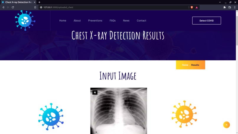 COVID 19 Detection with Chest X-Ray | Devpost