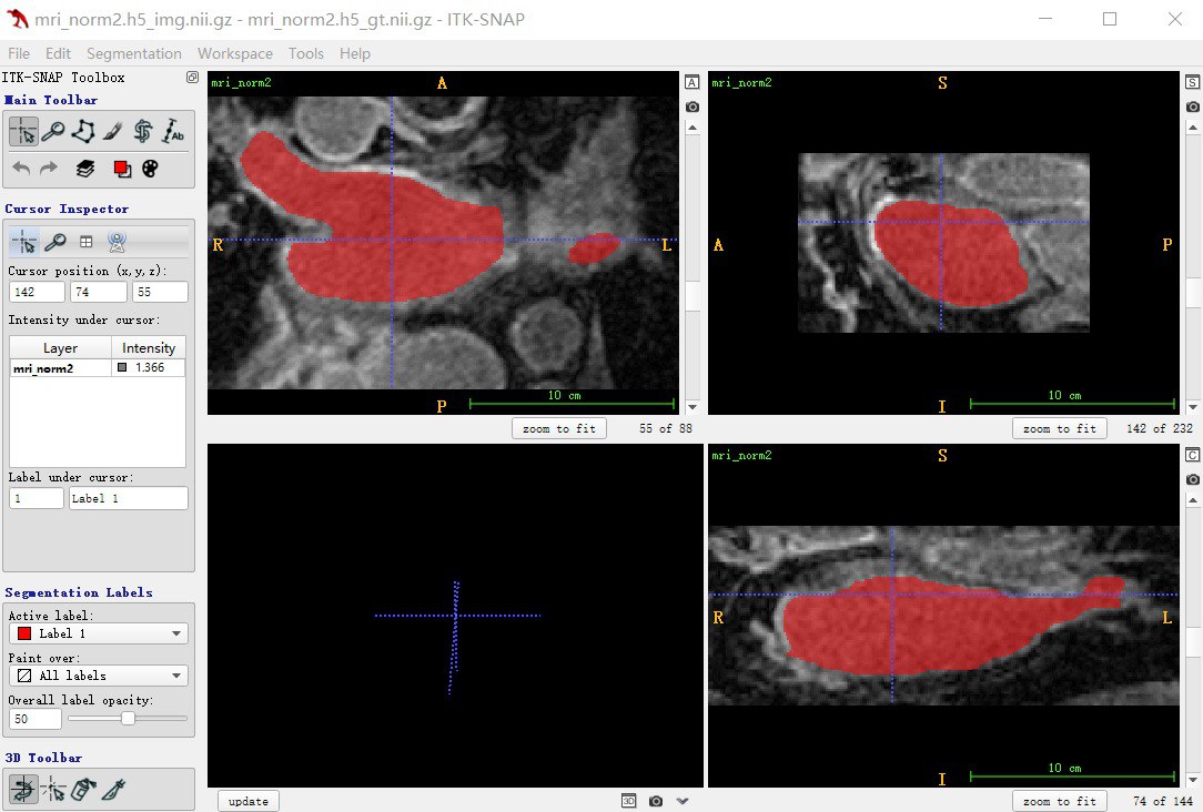 Savant’s Project | Devpost