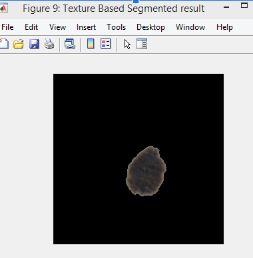 TEXTURE BASED SKIN LESION SEGMENTATION USING DenseNET101 | Devpost