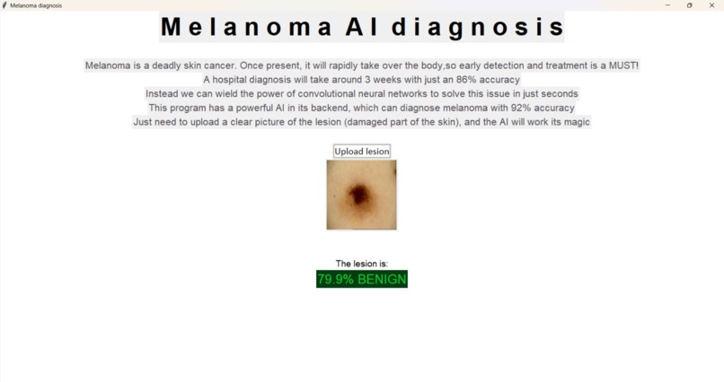 Skin Cancer AI diagnosis | Devpost