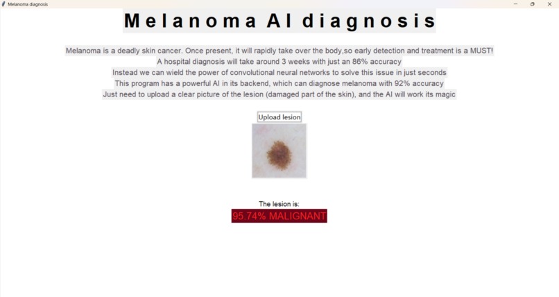Skin Cancer AI diagnosis | Devpost