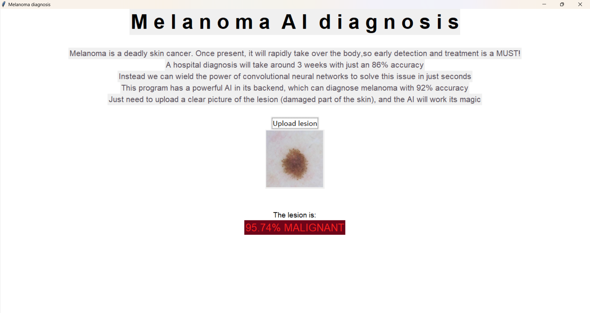 Skin Cancer AI diagnosis | Devpost
