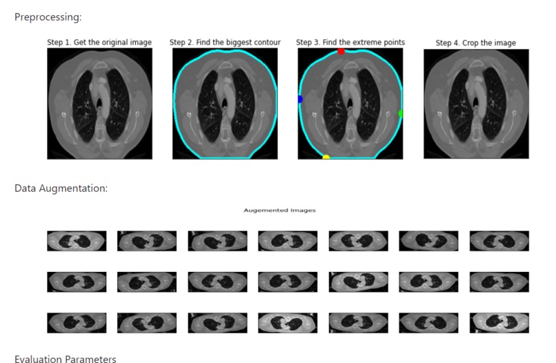 Chest-CT Scan Application | Devpost