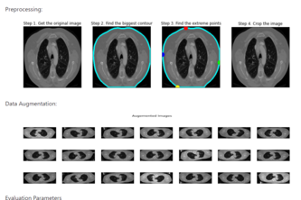 Chest-CT Scan Application | Devpost
