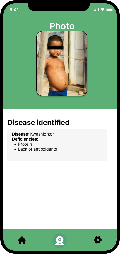 NutriVision | Devpost