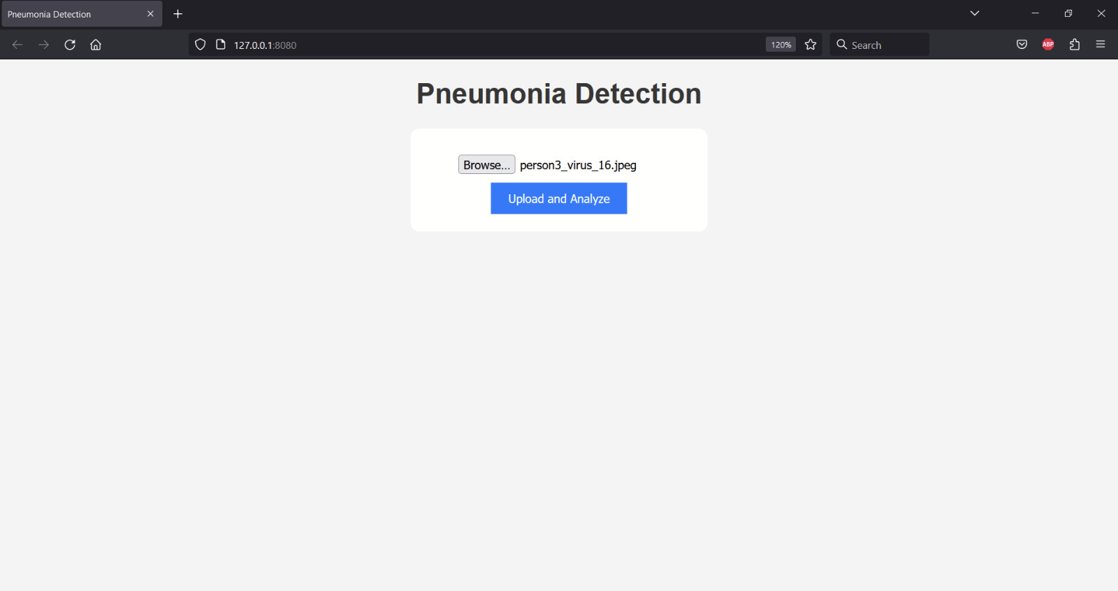 Detection Of Pneumonia Devpost
