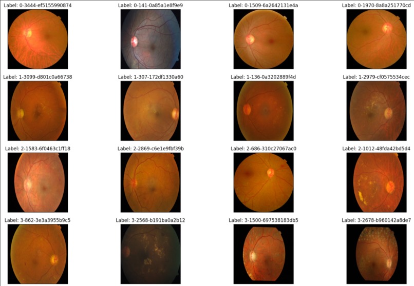 EyeSnap : Diabetic Retinopathy Detection with DiaScan | Devpost