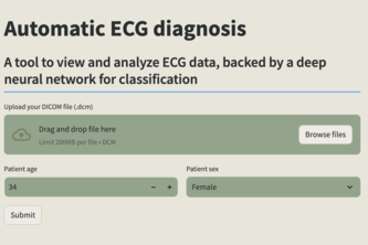ECG Analyzer | Devpost