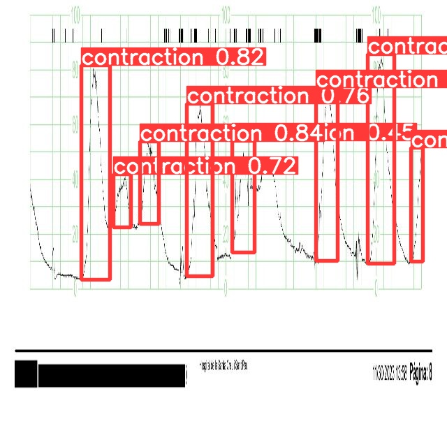 Toros - Les línies de la vida | Devpost