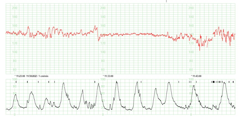 Detección de las características de los RCTG | Devpost