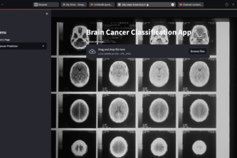 Finding Cancer From X-Ray Images | Devpost