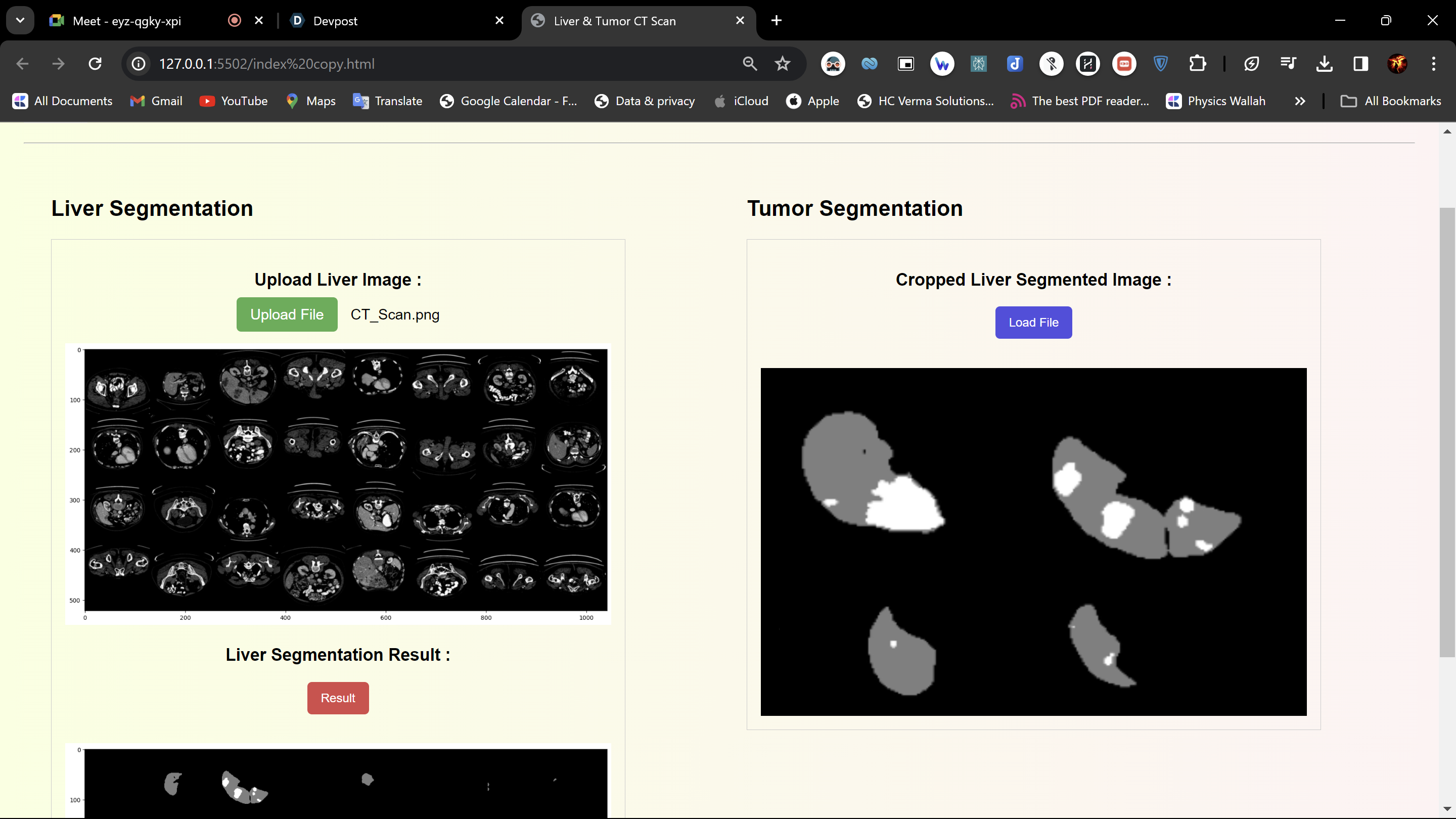 HepaScope: Advanced Liver Segmentation Project | Devpost HepaScope: Advanced Liver Segmentation Project | Devpost