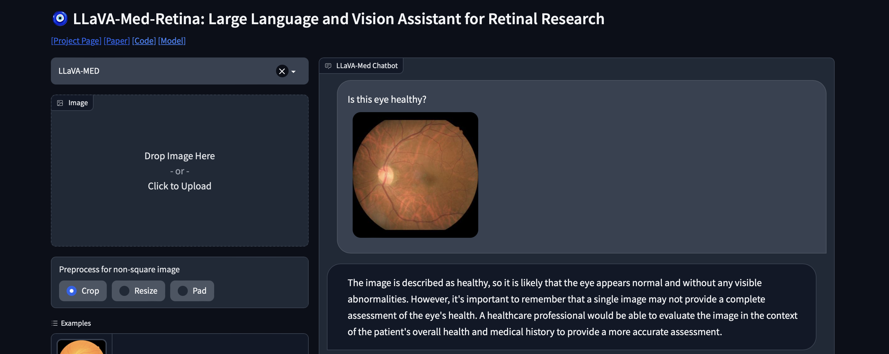 LLaVA-Med-Retina | Devpost