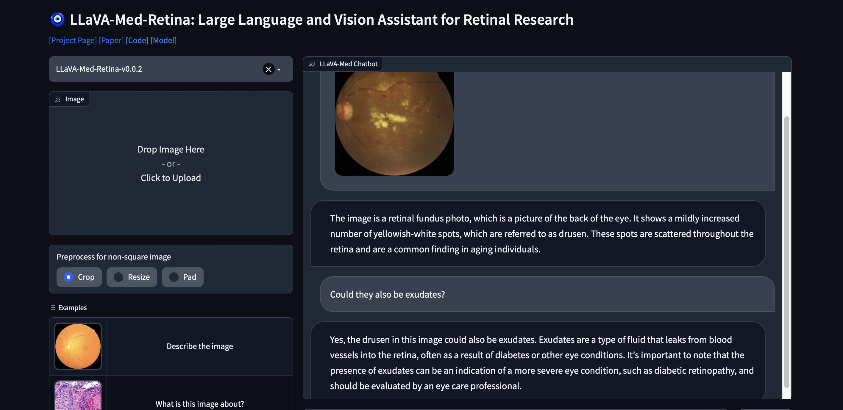 LLaVA-Med-Retina | Devpost