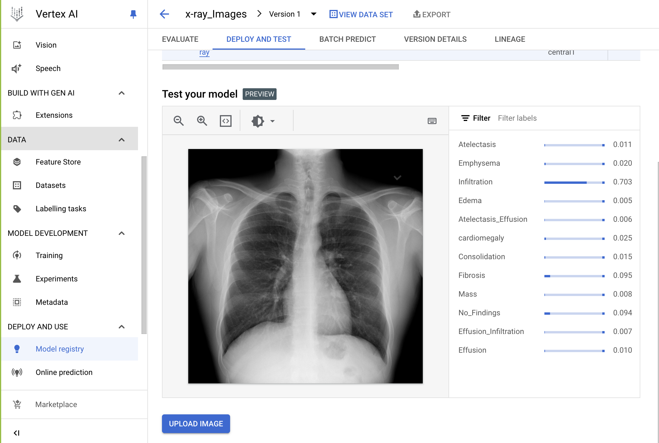AI-Based Chest Disease Diagnosis from X-Ray Images | Devpost