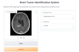 Brain Tumor Identification System | Devpost