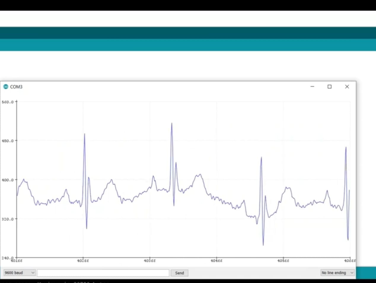 Real-Time Visualization of ECG and EMG Signals Indication | Devpost