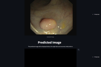 A Tumor Detection Model/Application | Devpost