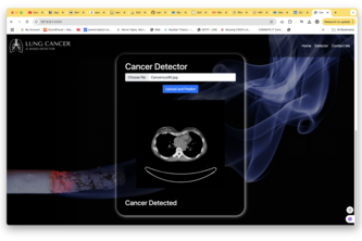 LUNG-AI: AI-Powered Lung Cancer Detection | Devpost