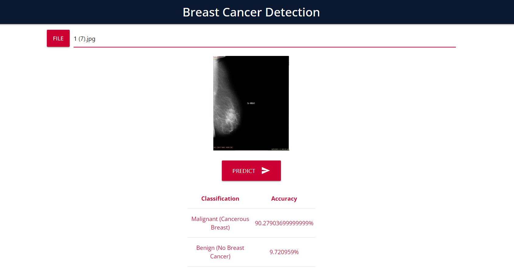 Breast Cancer | Devpost