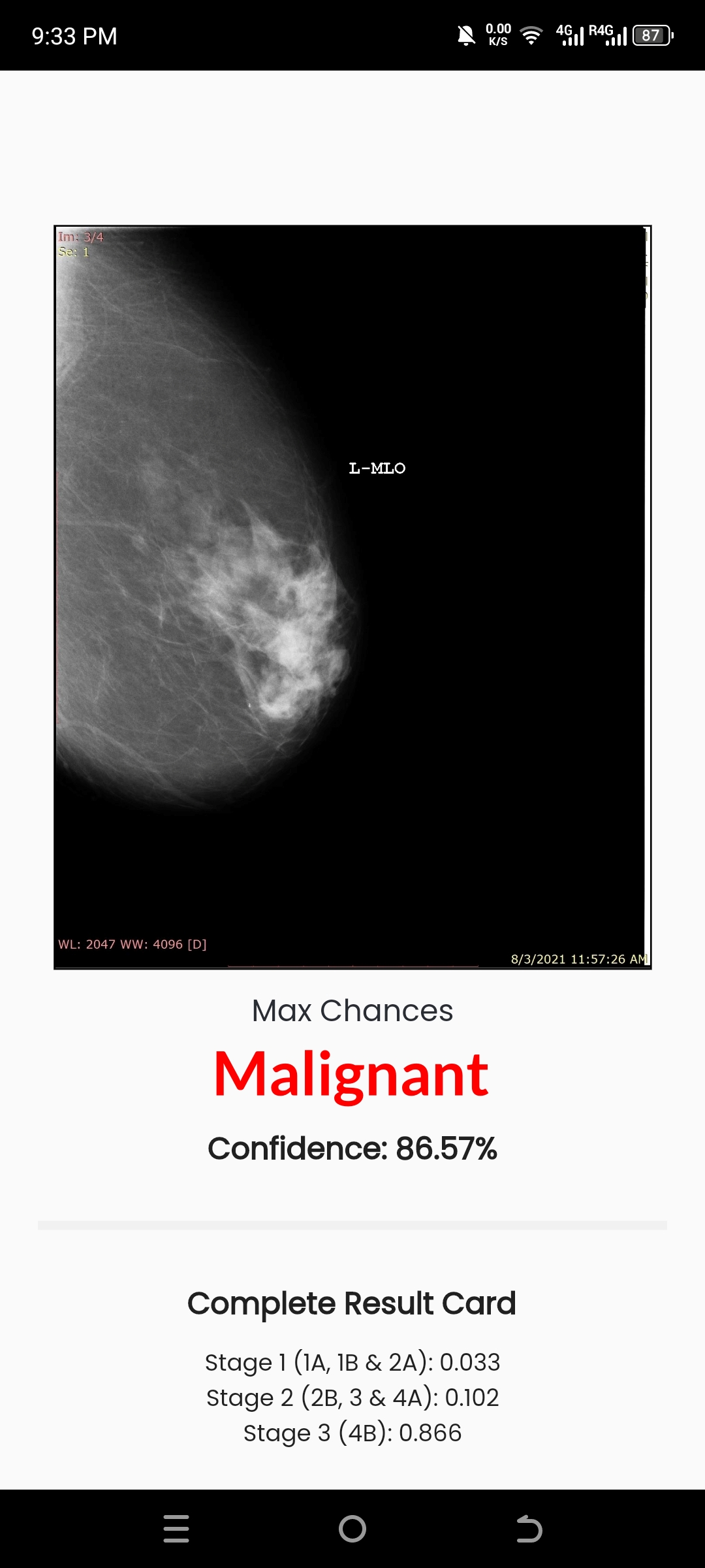 Breast Cancer | Devpost