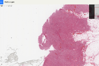 Path-o-gen | Devpost