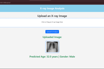 Age_Gender_by_XRay | Devpost