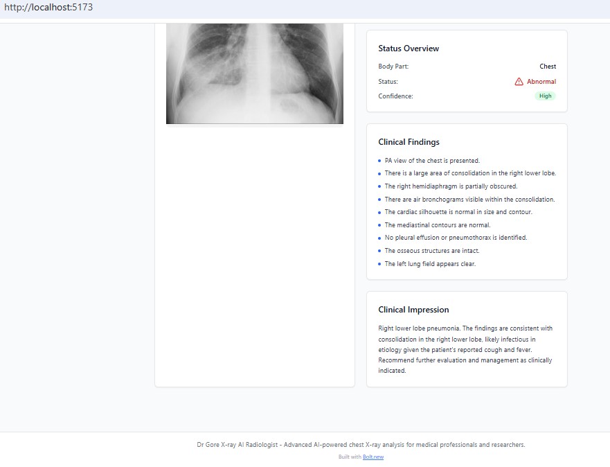 X-ray AI Radiologist -Advanced Chest X-ray Analysis | Devpost