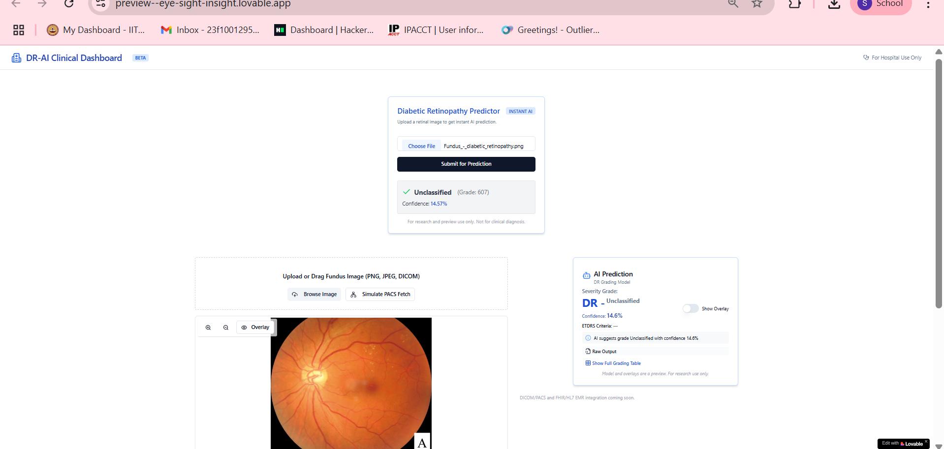 eye-sight-insight | Devpost