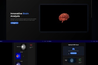 Brain-Tumor-Detection | Devpost