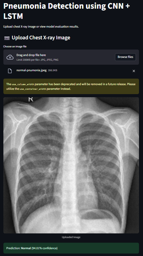 Pneumonia Disease Prediction | Devpost
