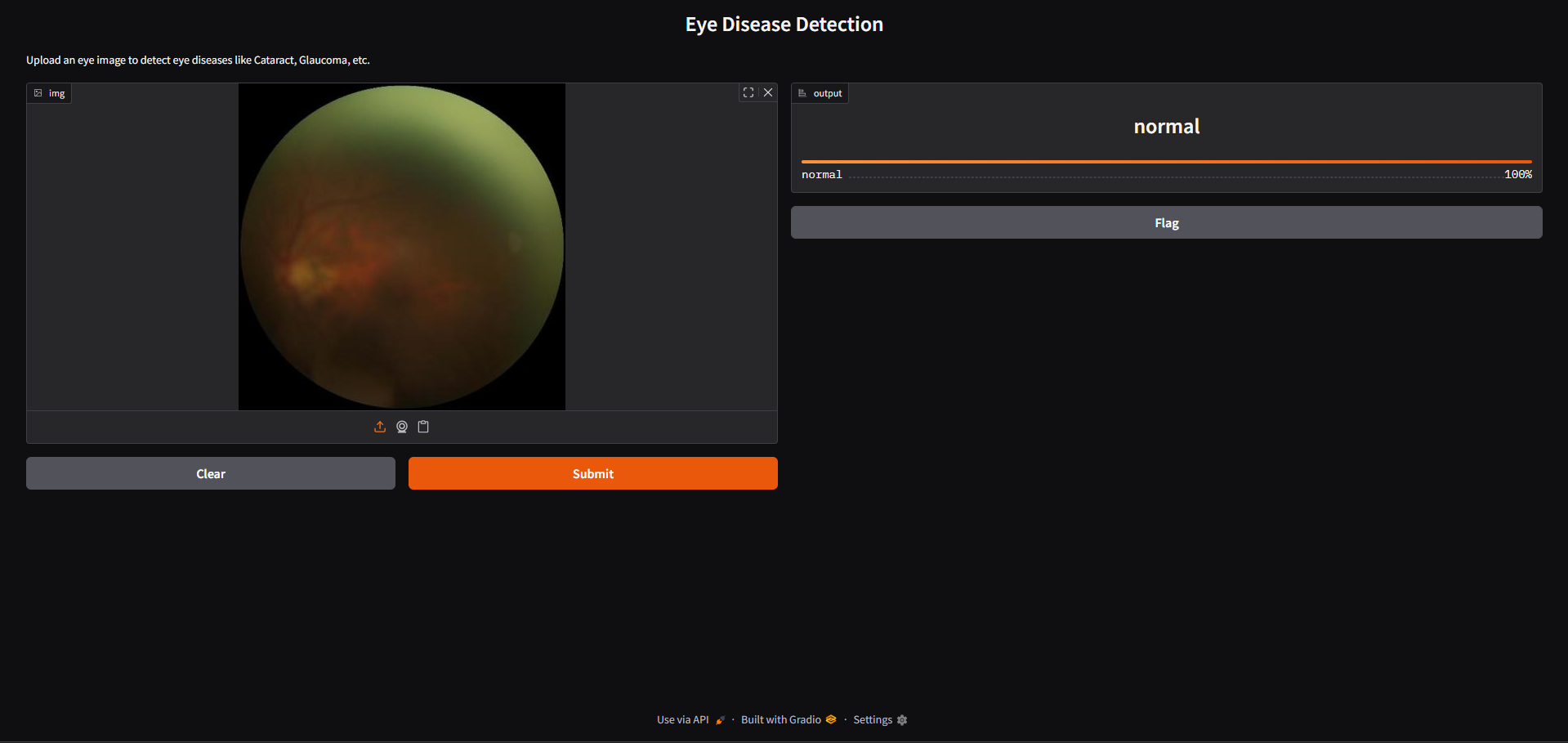 Eye Disease Detection Model | Devpost